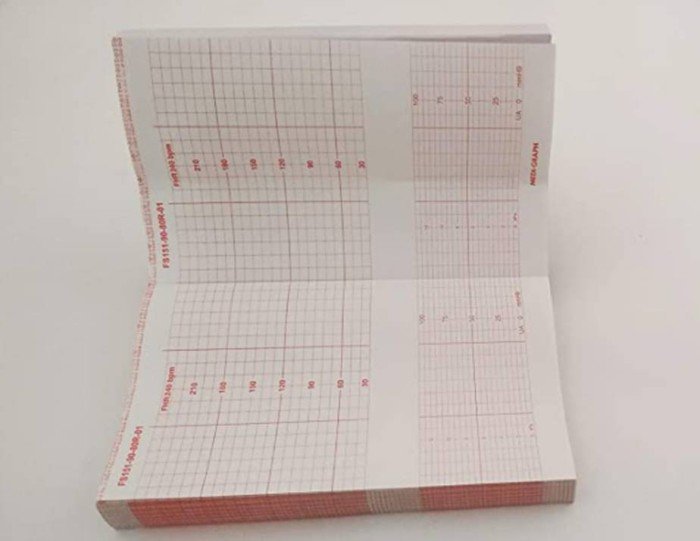 Recording paper for Fetal Monitors – Badawneh Medical Group